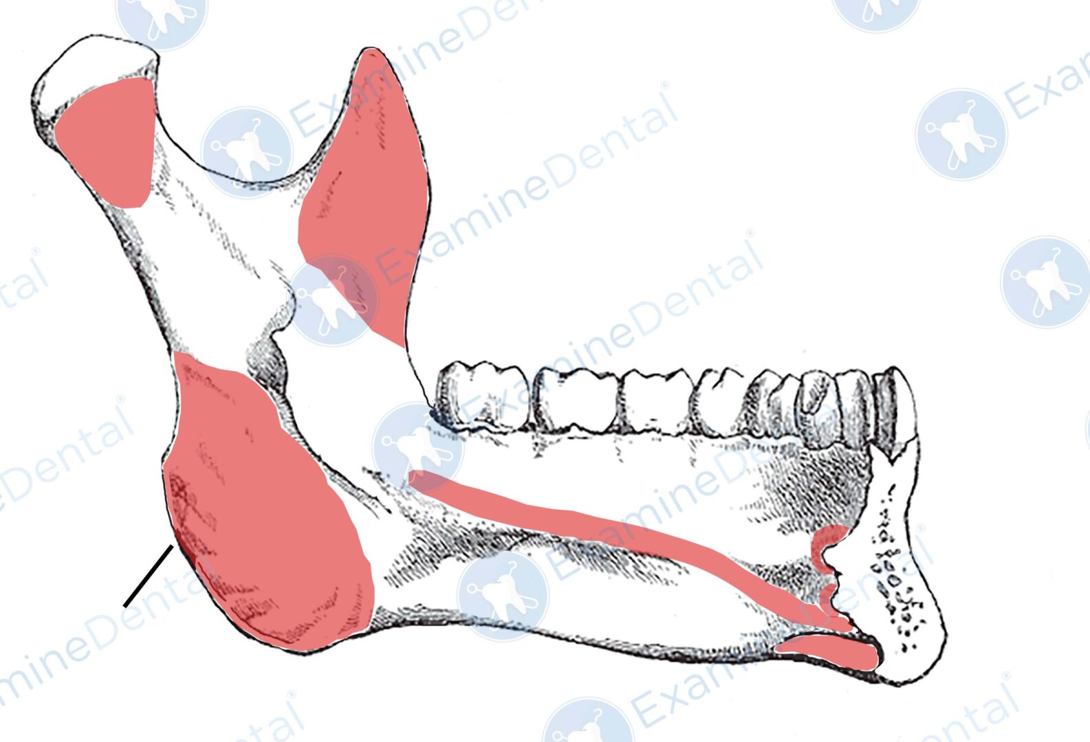 Anatomy of the Mandible - ExamineDental