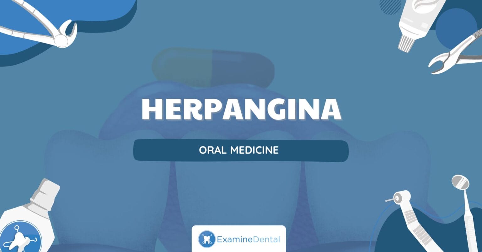 Herpangina - Presentation and Management - ExamineDental