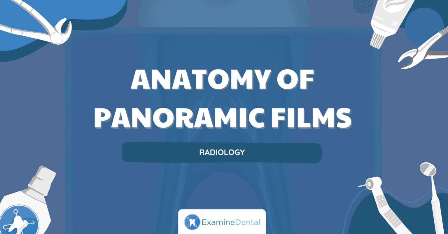Anatomy of Panoramic Films - OPTs/DPTs/OPGs - ExamineDental