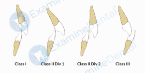 Incisor and Canine Classifications - ExamineDental